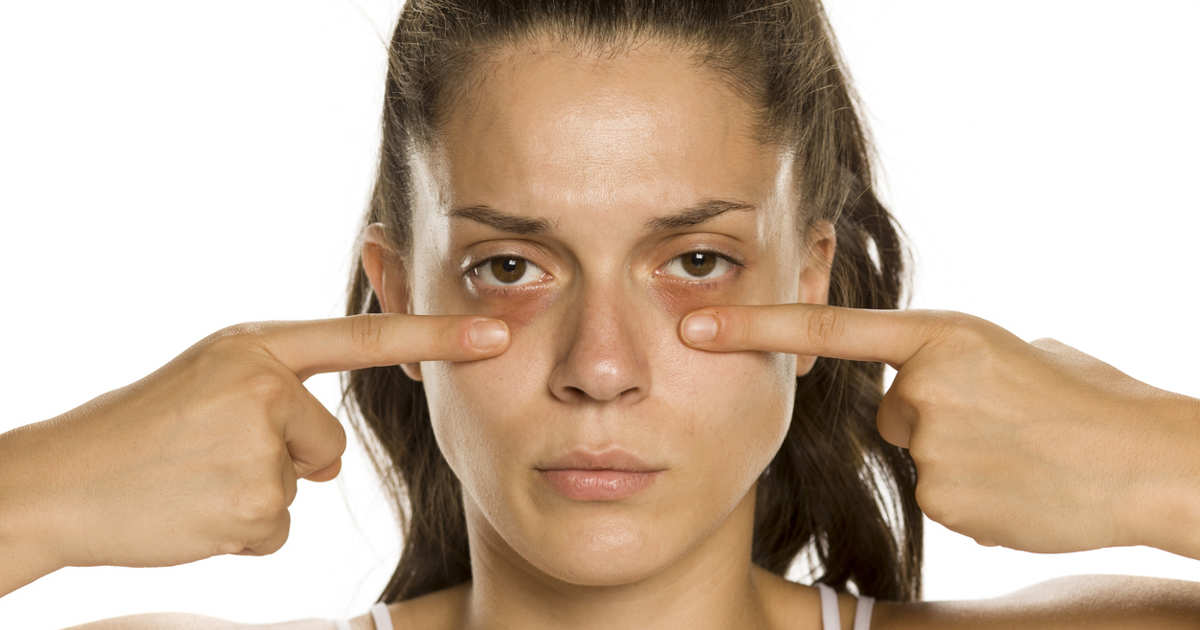 Ojeras: por qué se producen y cómo eliminarlas